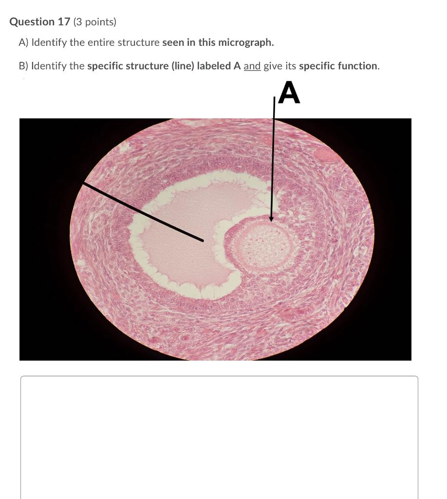 Solved Question 17 (3 points) A) Identify the entire | Chegg.com
