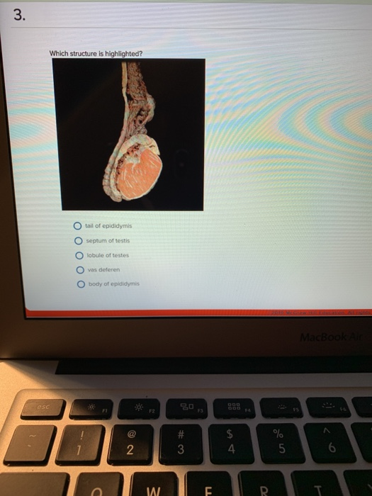 Solved 1. Which structure is highlighted? O prepuce O corpus | Chegg.com
