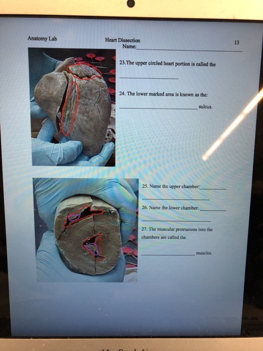 Heart Dissection Anatomy Lab Answers at Russell Hixson blog