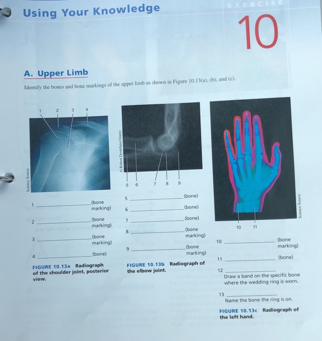Solved Using Your Knowledge 10 A. Upper Limb Identify the | Chegg.com
