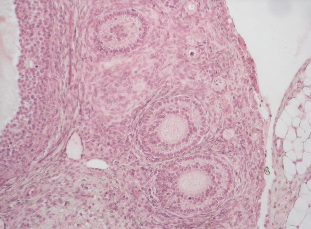- Primordial follicle - Primary unilaminar | Chegg.com