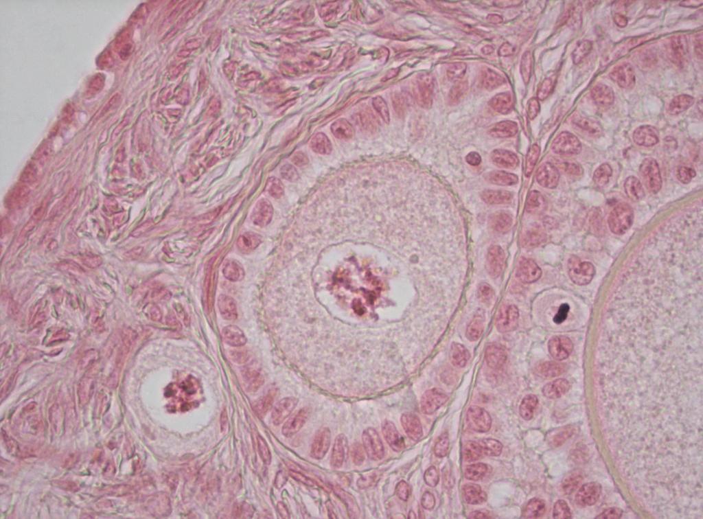 Solved Label the following structures ON BOTH | Chegg.com