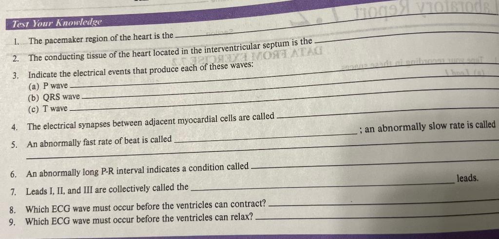 Solved Test Your Knowledge 1 The Pacemaker Region Of The