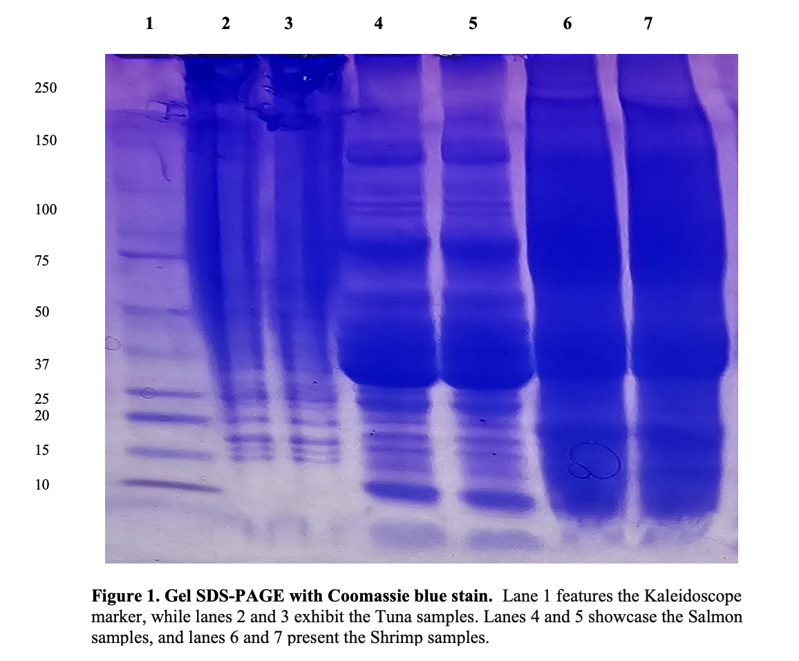 Solved Figure 1. Gel SDS-PAGE with Coomassie blue stain. | Chegg.com