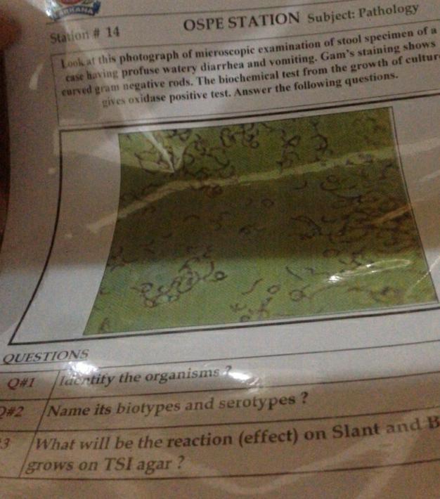 Solved Station # 14 OSPE STATION Subject: Pathology Look at | Chegg.com