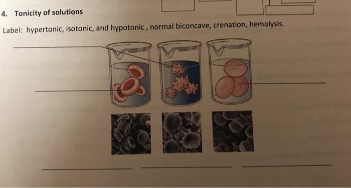 Solved Tonicity of solutions 4. Label: hypertonic, isotonic, | Chegg.com