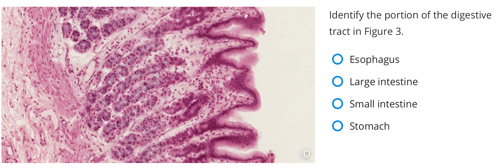 Solved Identify the portion of the digestive tract in Figure | Chegg.com