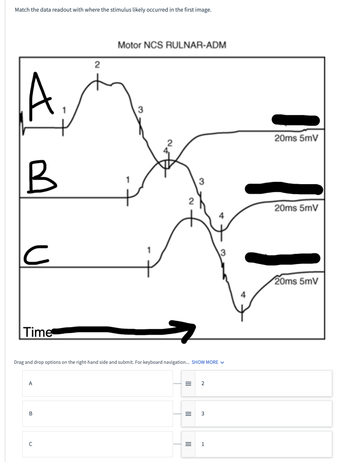 Solved Match the data readout with where the stimulus likely | Chegg.com