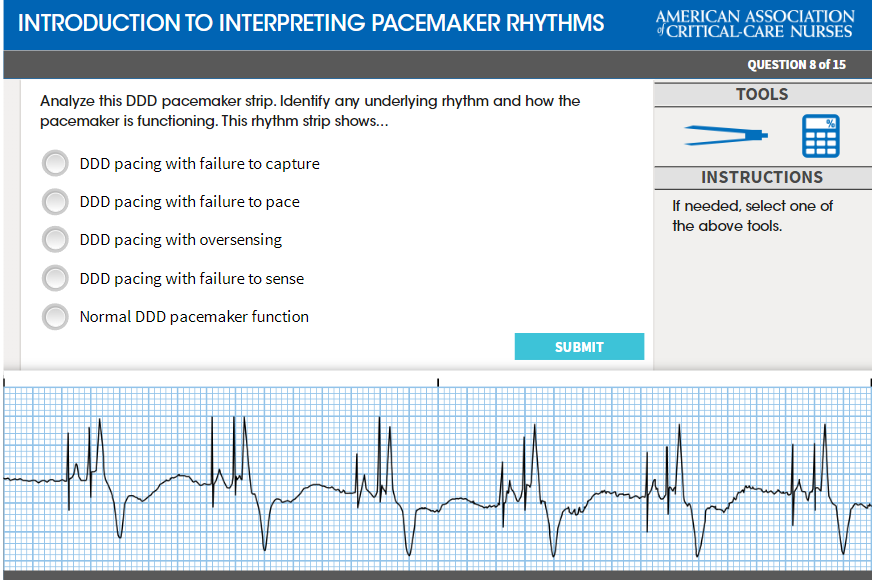 [Solved]: Analyze this DDD pacemaker strip. Identify any und