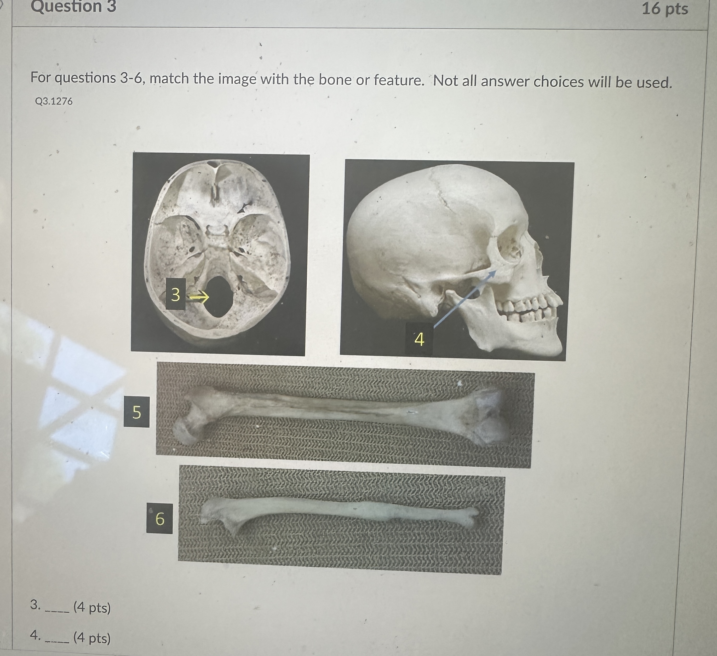 Solved For questions 3-6, match the image with the bone or | Chegg.com