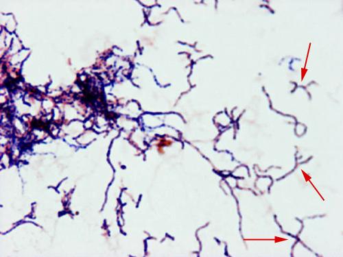 Gram Positive Pleomorphic Rods