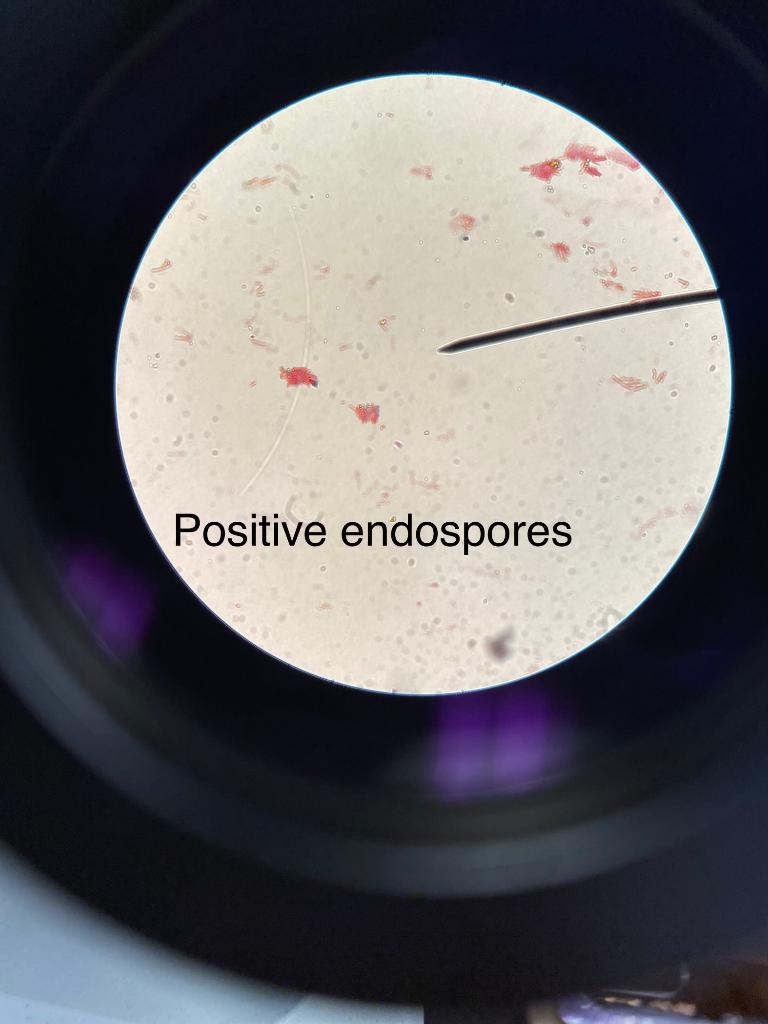 Solved 1 Negative acid-fast Positive for | Chegg.com