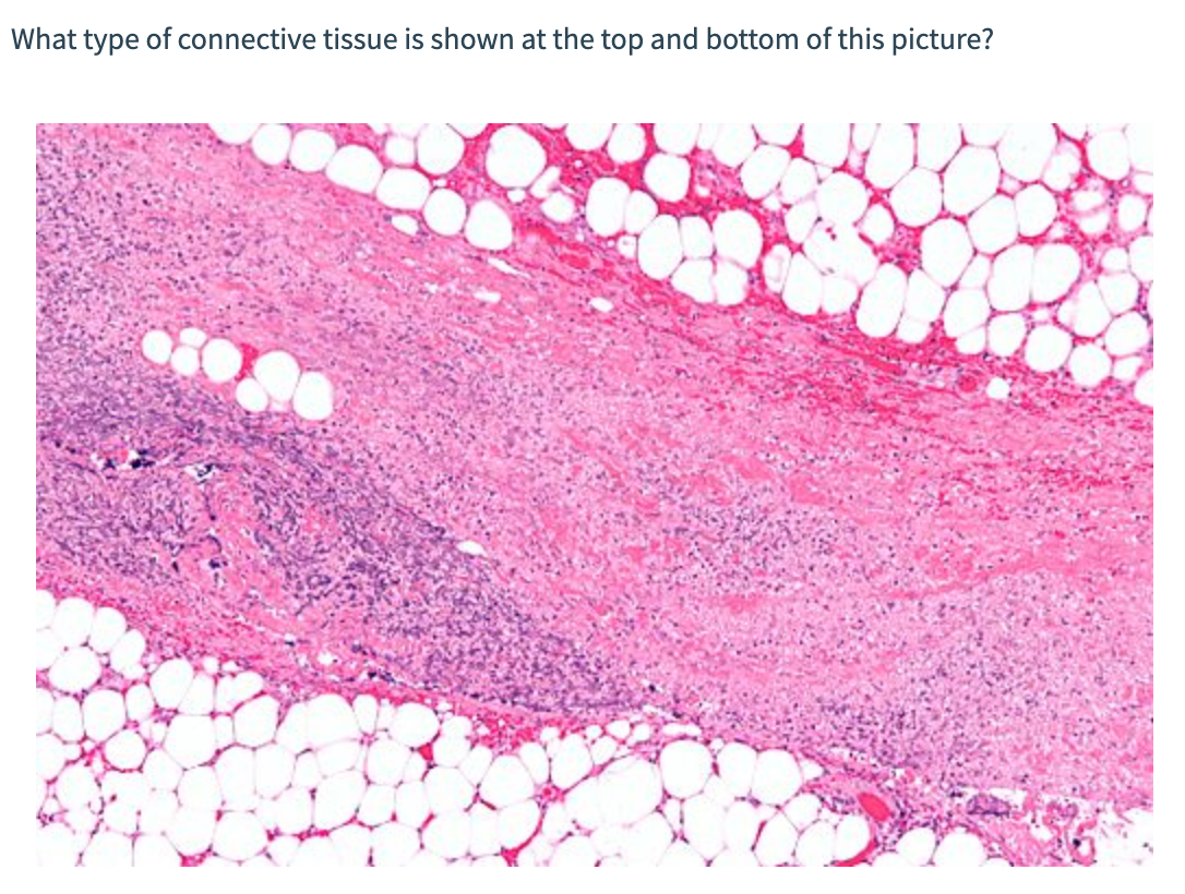 Solved What type of connective tissue is shown at the top | Chegg.com