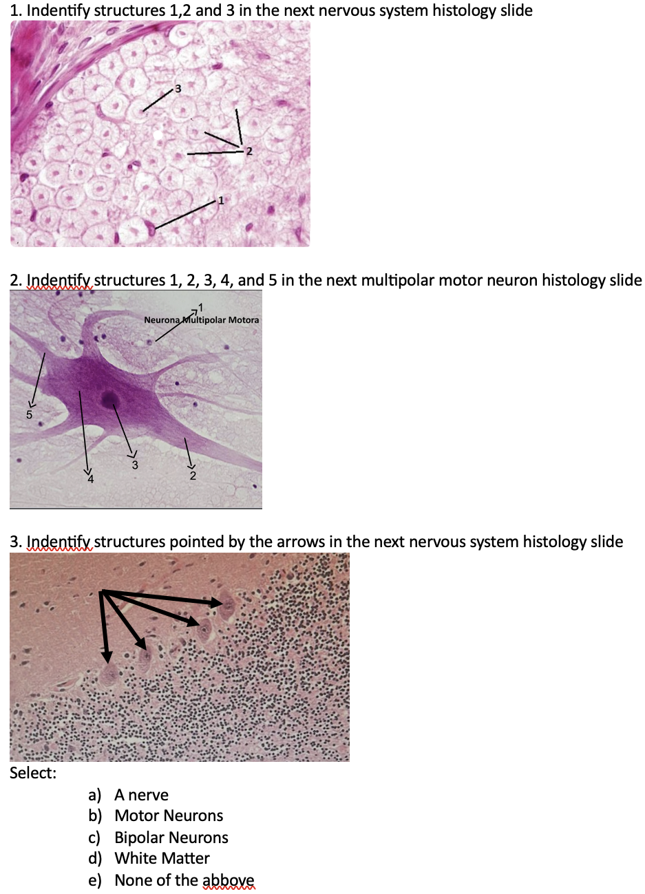 Solved 1.Indentify structures 1,2 ﻿and 3 ﻿in the next | Chegg.com