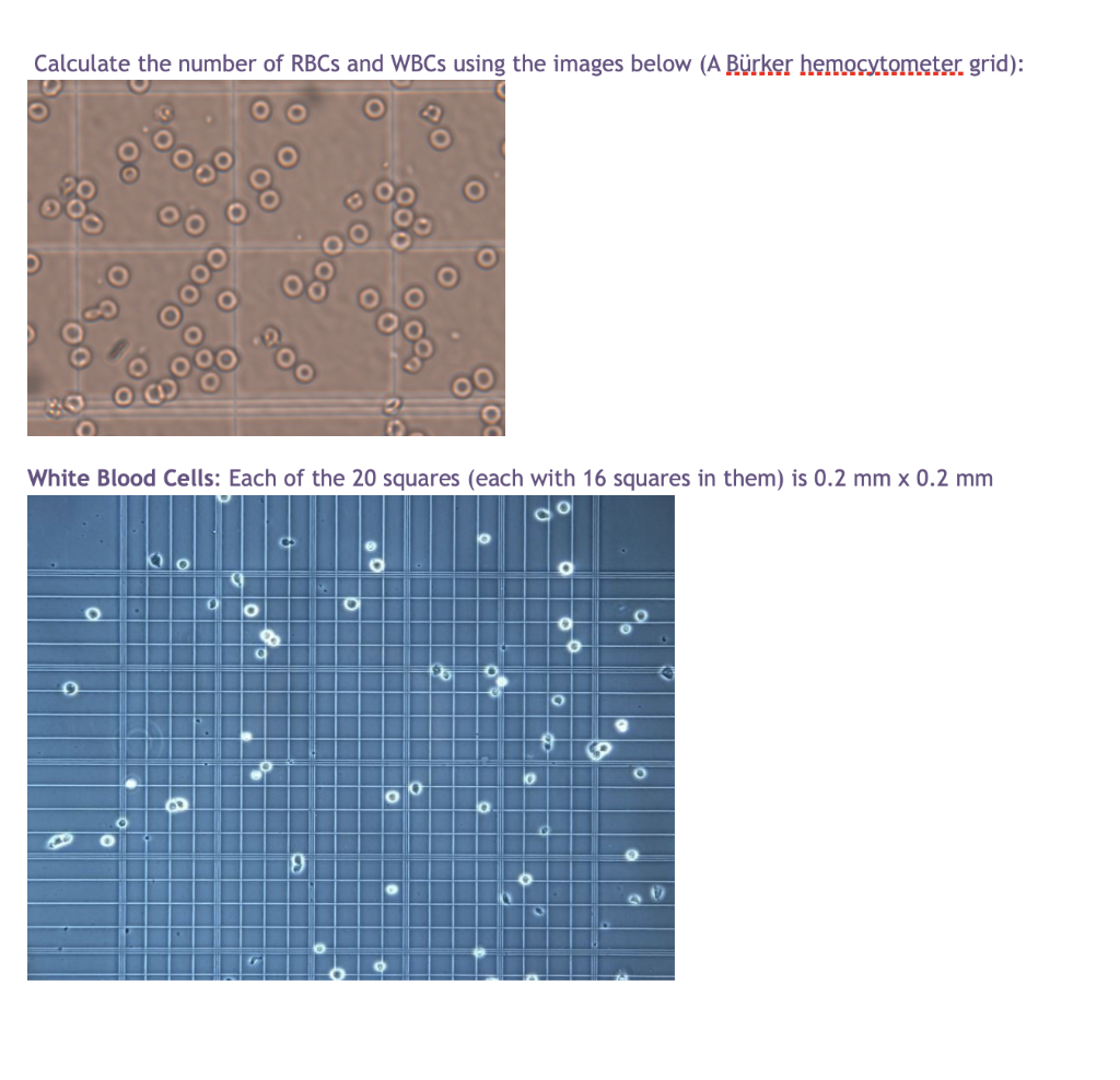 Solved Calculate The Number Of RBCs And WBCs Using The Chegg
