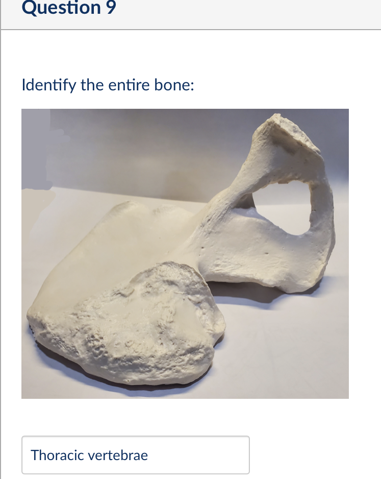Solved Identify the following bone: Question 12 Identify | Chegg.com