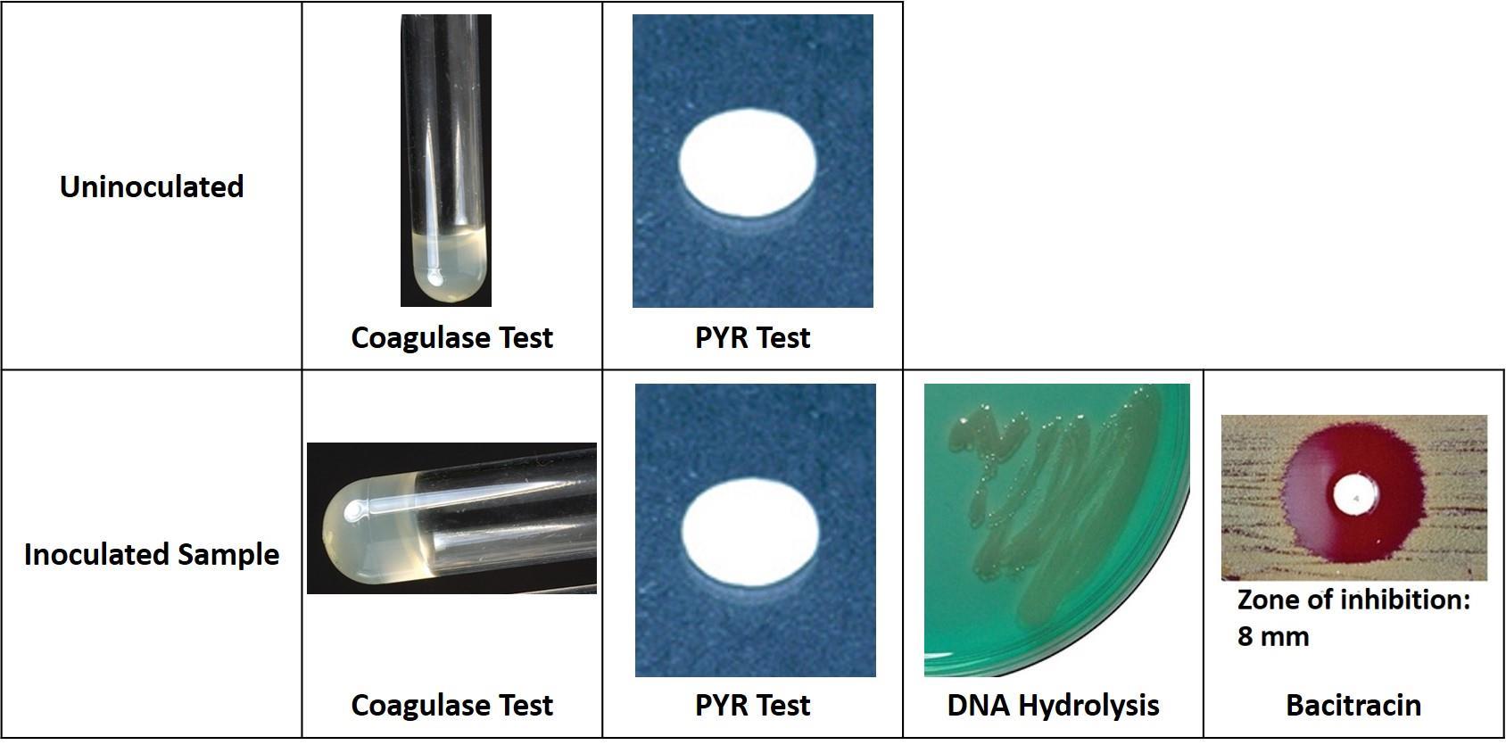 Solved 1.Examine the biochemical test results below and | Chegg.com