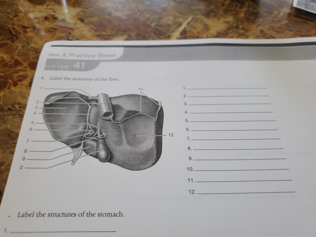 Solved iew& Practice Sheet . Label the anatomy of the liver | Chegg.com