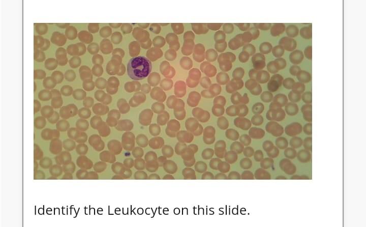 Solved Identify the Leukocyte on this slide. | Chegg.com
