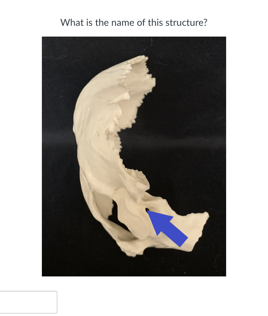 Solved What is the name of this structure? | Chegg.com