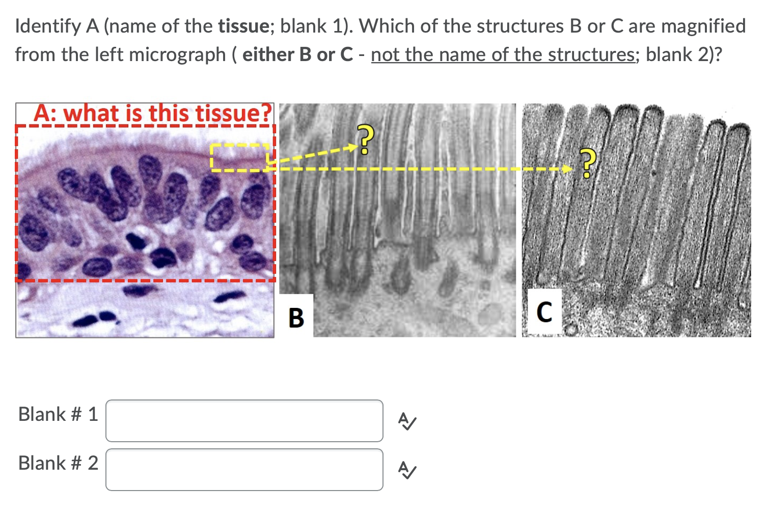 Solved Identify A (name of the tissue; blank 1). Which of | Chegg.com