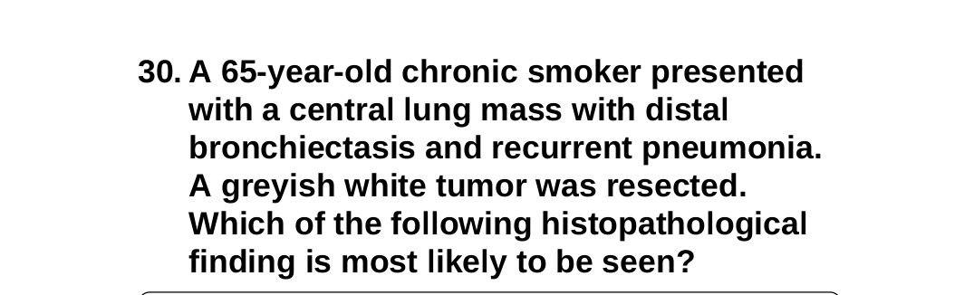 30. A 65-year-old chronic smoker presented with a | Chegg.com