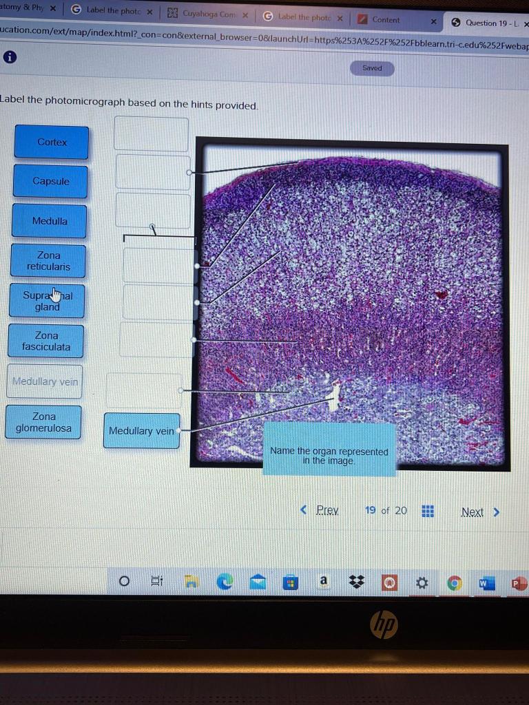 Solved atomy & Phy X G Label the photo X 23 Cuyaloga Com x G | Chegg.com