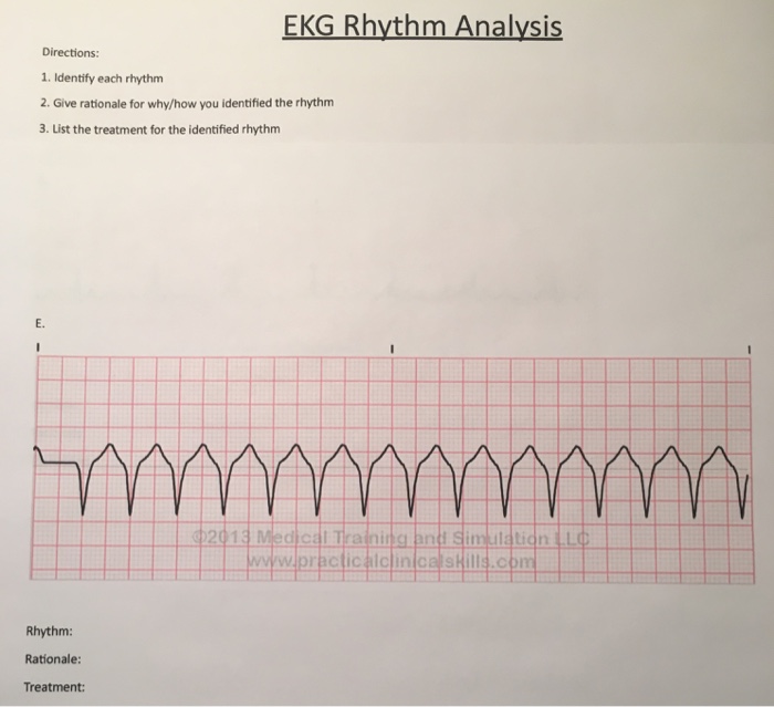 Solved EKG Rhythm Analysis Directions: 1. Identify each | Chegg.com