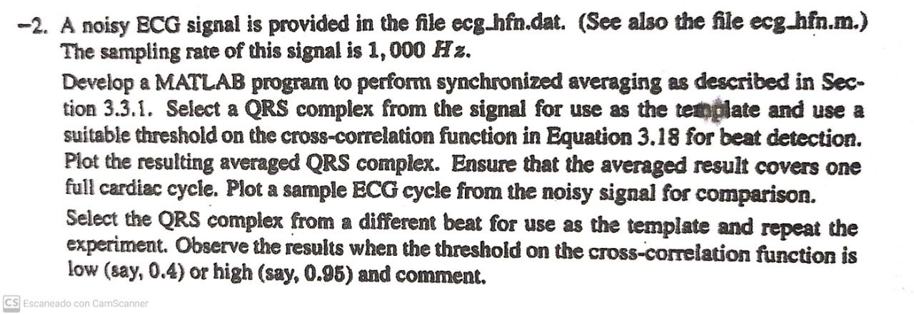 -2. A noisy ECG signal is provided in the file ecg | Chegg.com