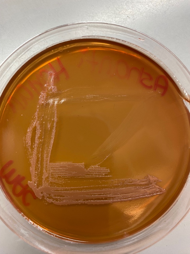 Solved Does my MacConkey plate have lactose fermenting | Chegg.com