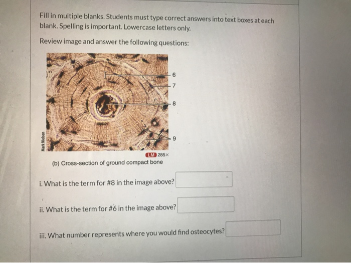 Solved Fill in multiple blanks. Students must type correct | Chegg.com