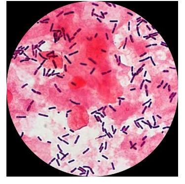 Solved The image pictured is of a Gram stain performed on an | Chegg.com