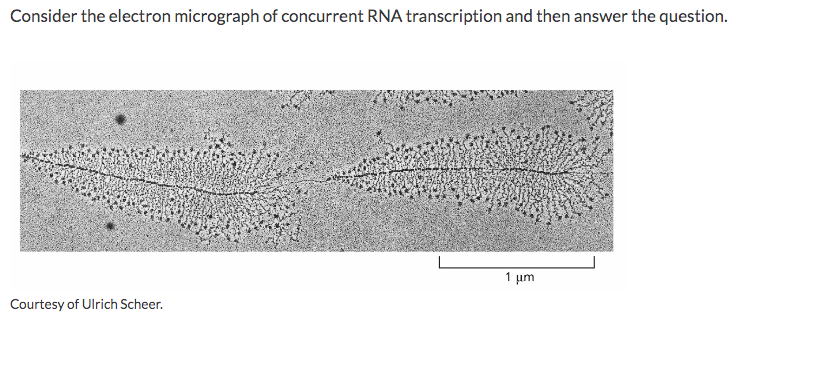 Solved Consider the electron micrograph of concurrent RNA | Chegg.com