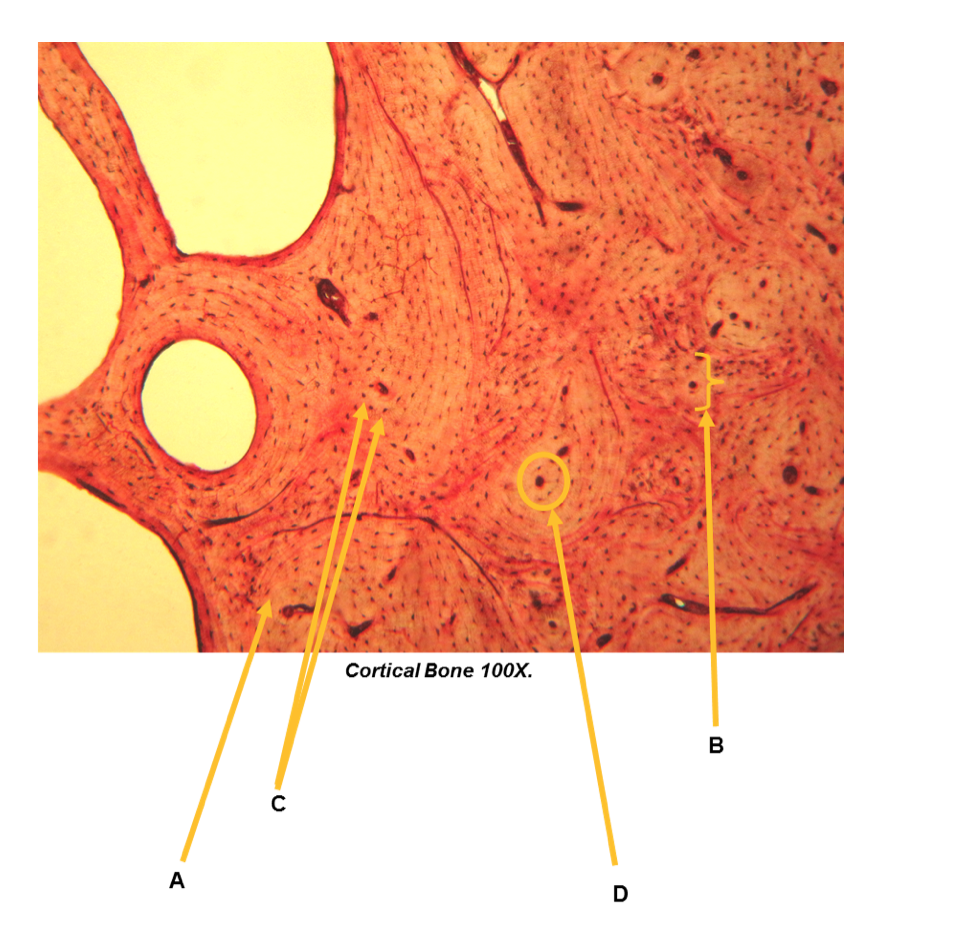 Solved Trabecular Bone: 100X | Chegg.com