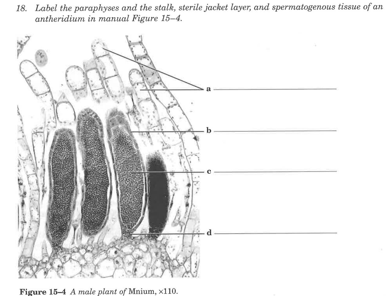 Solved 18. Label the paraphyses and the stalk, sterile | Chegg.com