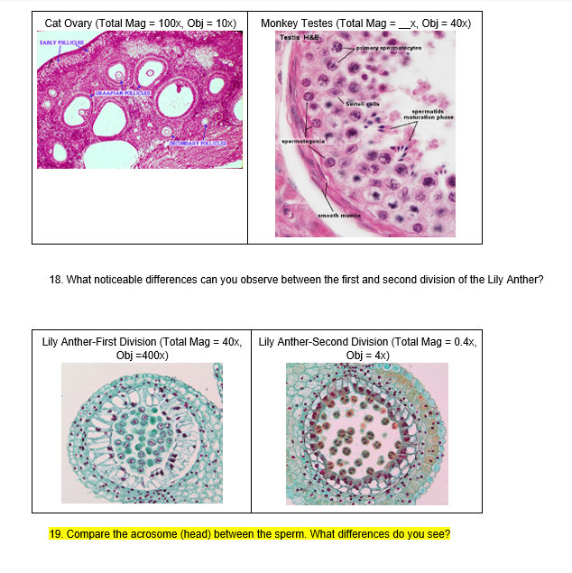 Solved Cat Ovary (Total Mag = 100x, Obj = 10x) Monkey Testes | Chegg.com