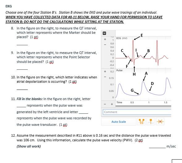 Solved EKG Choose one of the four Station B's. Station B | Chegg.com