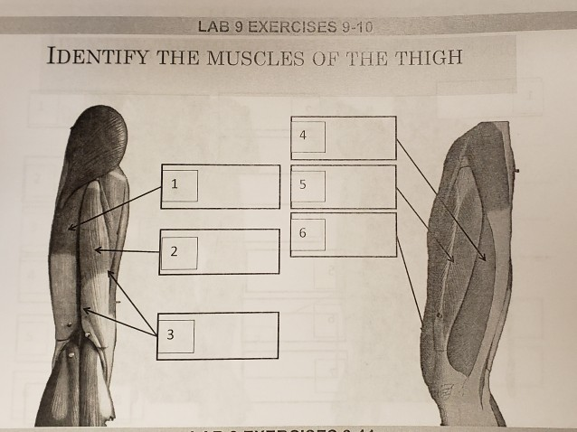 Solved LAB 9 EXERCISES 9-10 IDENTIFY THE MUSCLES OF THE | Chegg.com Solved LAB 9 EXERCISES 9-10 IDENTIFY THE MUSCLES OF THE | Chegg.com