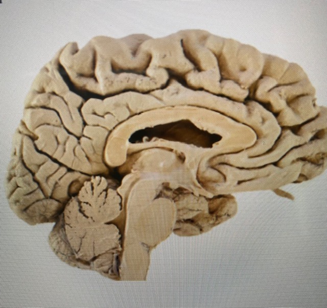 Solved ON THIS PICTURE, please label:A. medulla oblongataB. | Chegg.com