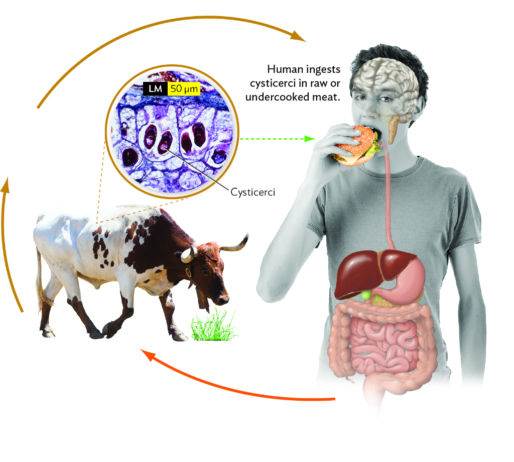 The cysticerci referred to in this figure | Chegg.com