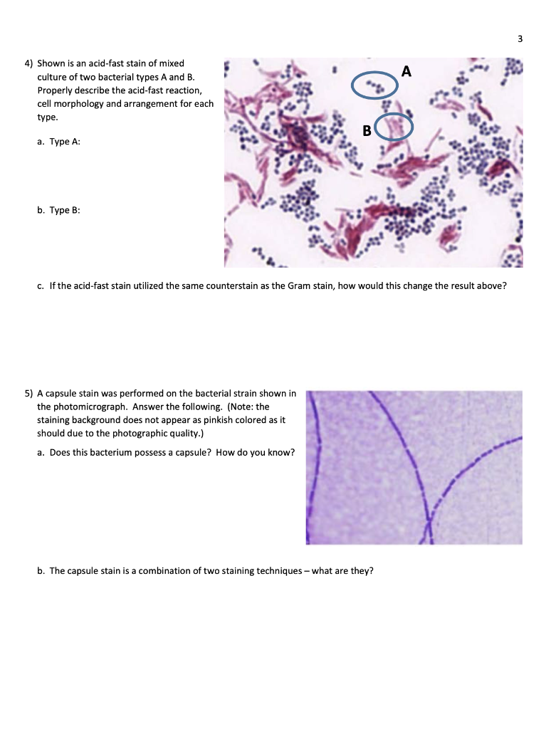 Solved A 4 Shown Is An Acid Fast Stain Of Mixed Culture Of