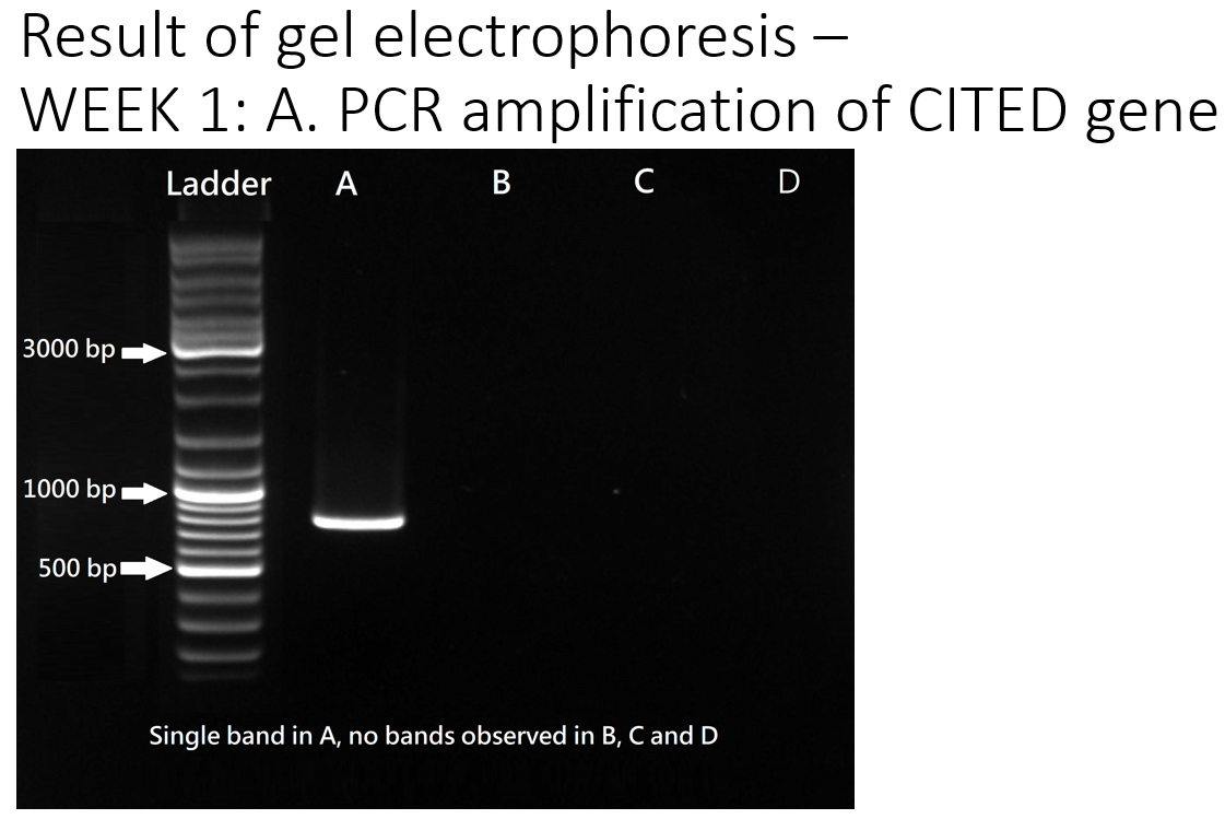 Solved Result of gel electrophoresis – WEEK 1: A. PCR | Chegg.com