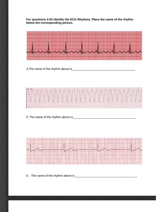 Solved For Questions 4 25 Identify The Ecg Rhythms Place