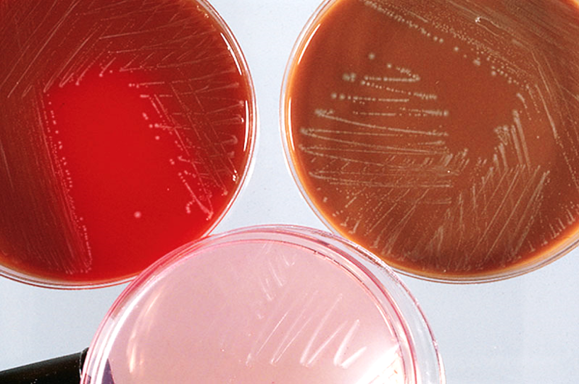 Kingella Growth On Blood Agar