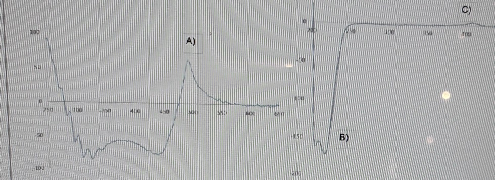 Solved HIC A) ORD spectrum showing a neutral cotton | Chegg.com