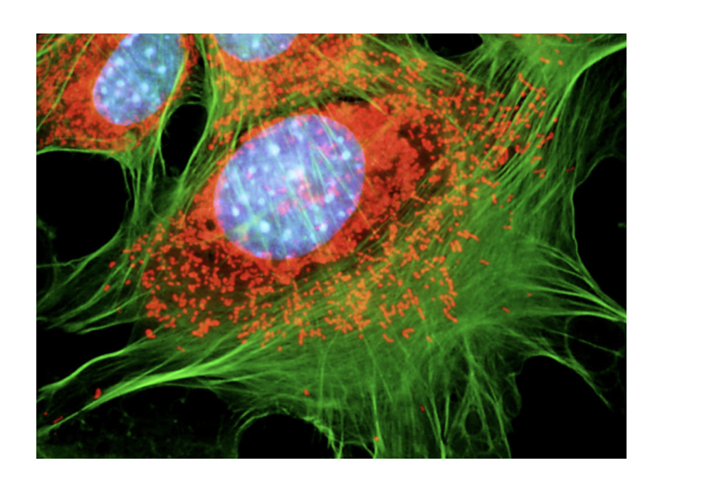 Label the image with the following subcellular | Chegg.com