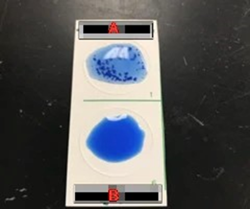 Coagulase testRecord results of the coagulase test. | Chegg.com