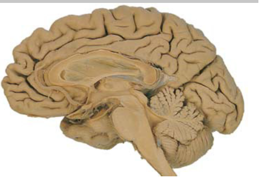 Solved Major gyri: Precentral gyrus Postcentral | Chegg.com
