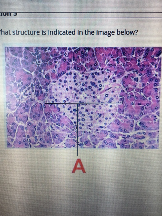 Solved 11. The activity of many end organs is regulated by | Chegg.com
