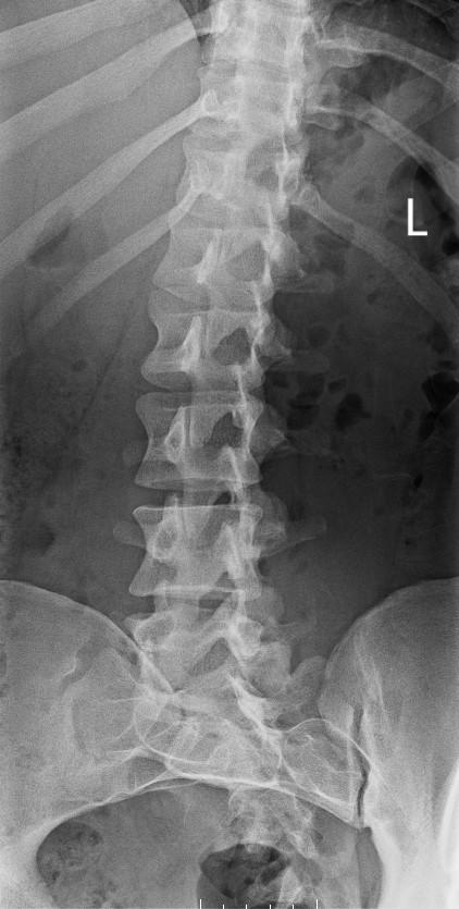 Solved be specific: Locate the left L3 pars | Chegg.com